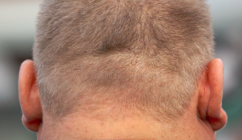Nape and ears of a fat man stock image. Image of nape - 180955183