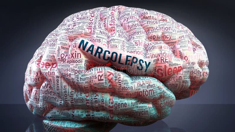 Narcolepsy and a Human Brain Stock Illustration - Illustration of ...