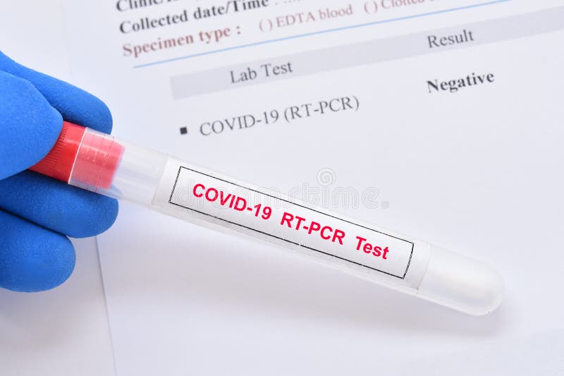 Nasopharyngeal Swab for COVID-19 RT-PCR Test Stock Photo - Image of ...