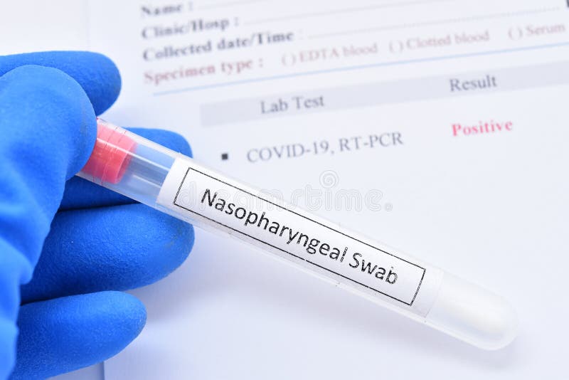 Nasopharyngeal Swab Positive with COVID-19 Stock Image - Image of ...