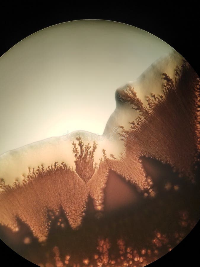 The Beautiful Art of Bacteria - Microscope View of Bacillus and Other ...