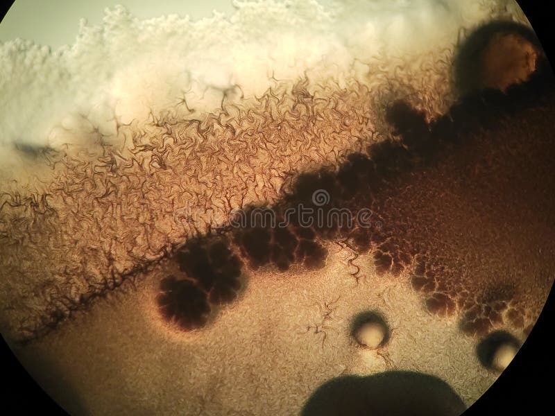 The Beautiful Art of Bacteria - Microscope View of Bacillus and Other ...