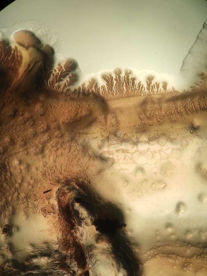The Beautiful Art of Bacteria - Microscope View of Bacillus and Other ...