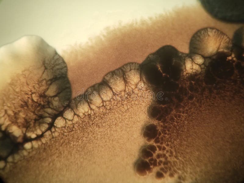 The Beautiful Art of Bacteria - Microscope View of Bacillus and Other ...