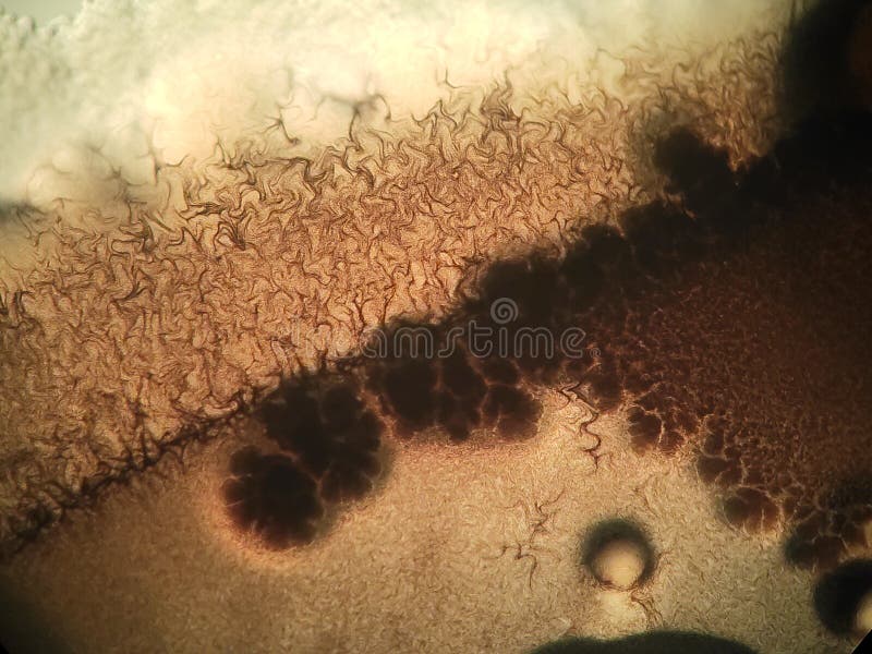 The Beautiful Art of Bacteria - Microscope View of Bacillus and Other ...