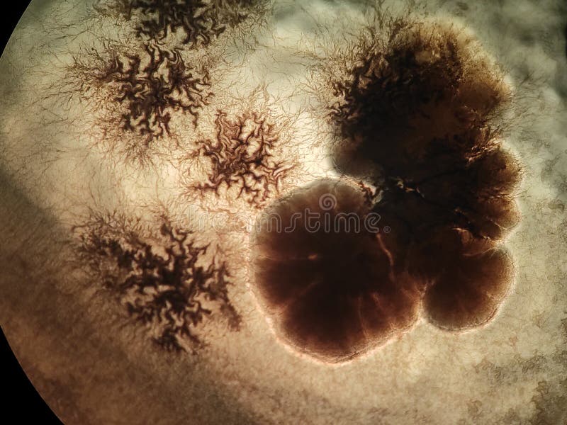 The Beautiful Art of Bacteria - Microscope View of Bacillus and Other ...