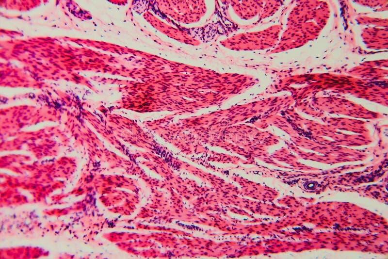 Bladder Cat- Animal Tissue Microscope Slides Stock Image - Image of ...