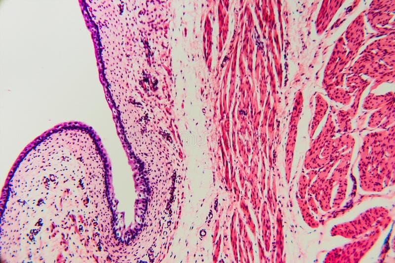 155 Urethra Cell Stock Photos - Free & Royalty-Free Stock Photos from ...