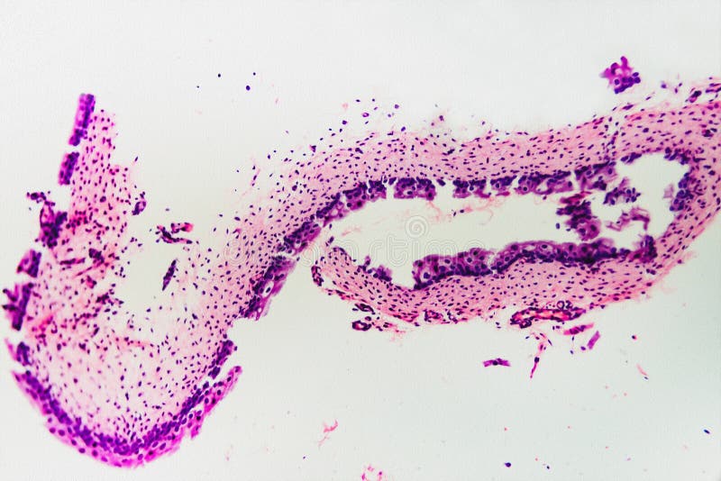 Bladder Cat- Animal Tissue Microscope Slides Stock Image - Image of ...