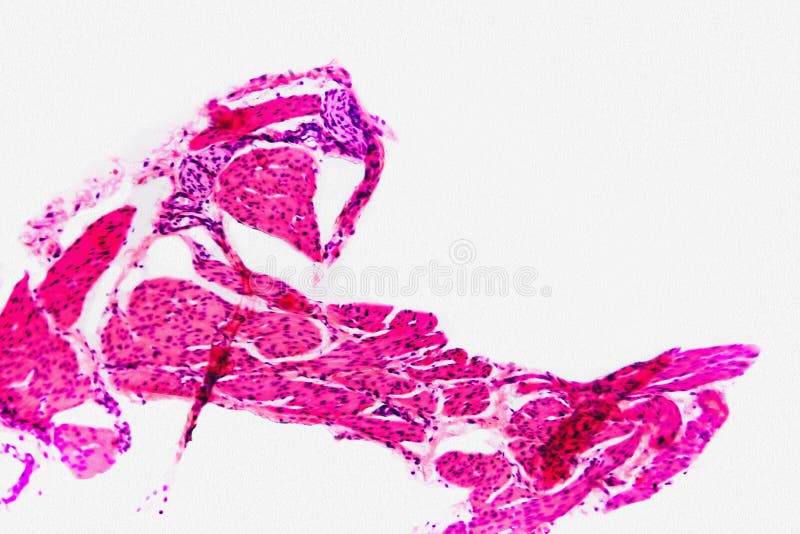 Bladder Cat- Animal Tissue Microscope Slides Stock Image - Image of ...