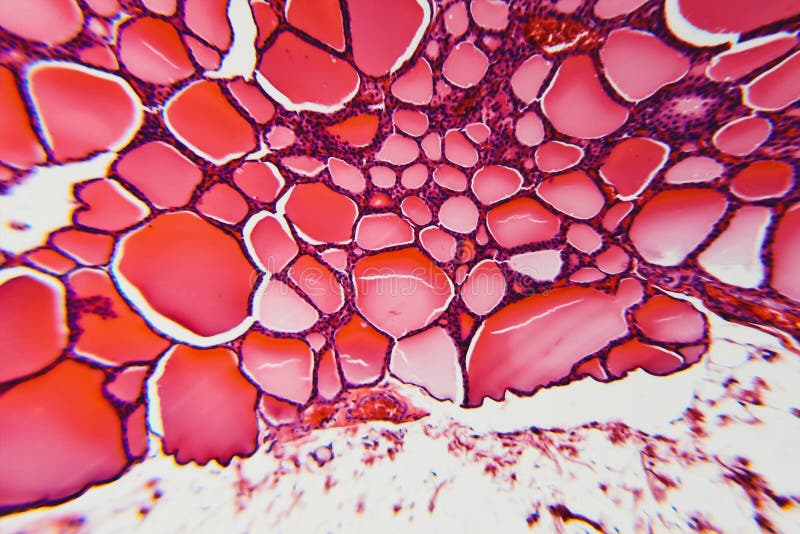 Thyroid Dogs Signs Stock Photos - Free & Royalty-Free Stock Photos from ...