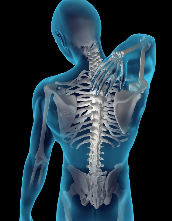 Neck/Back Pain stock illustration. Illustration of bone - 14244419