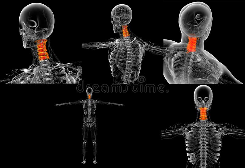 Neck bone stock illustration. Illustration of physiology - 88884971