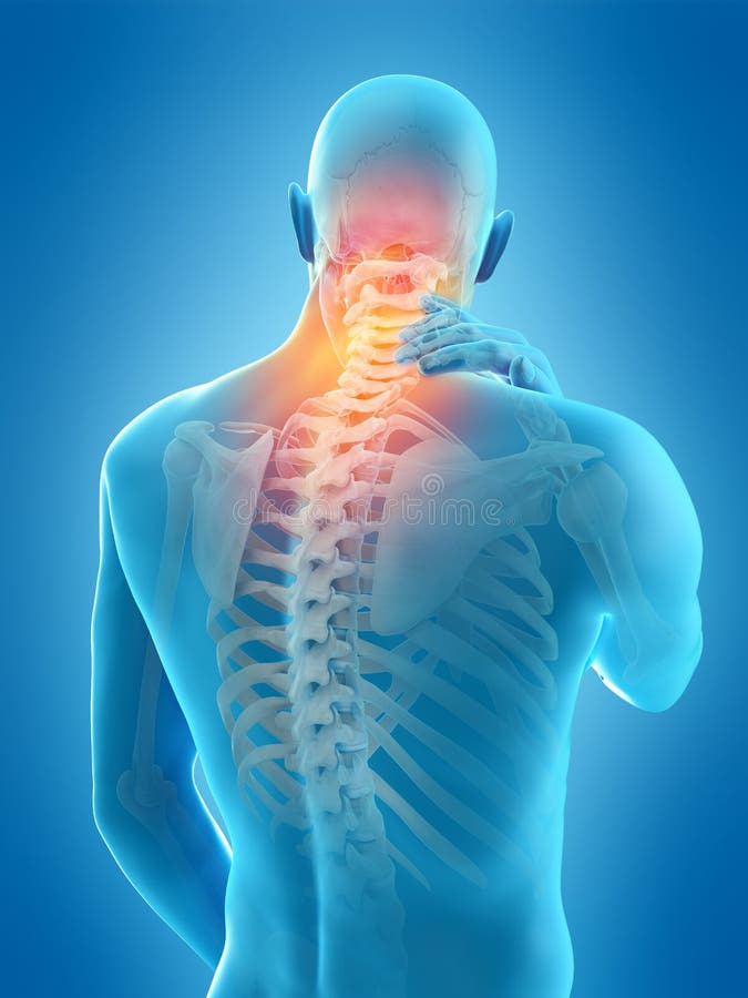 Anatomy of Male Back and Neck Pain in Blue Stock Illustration ...