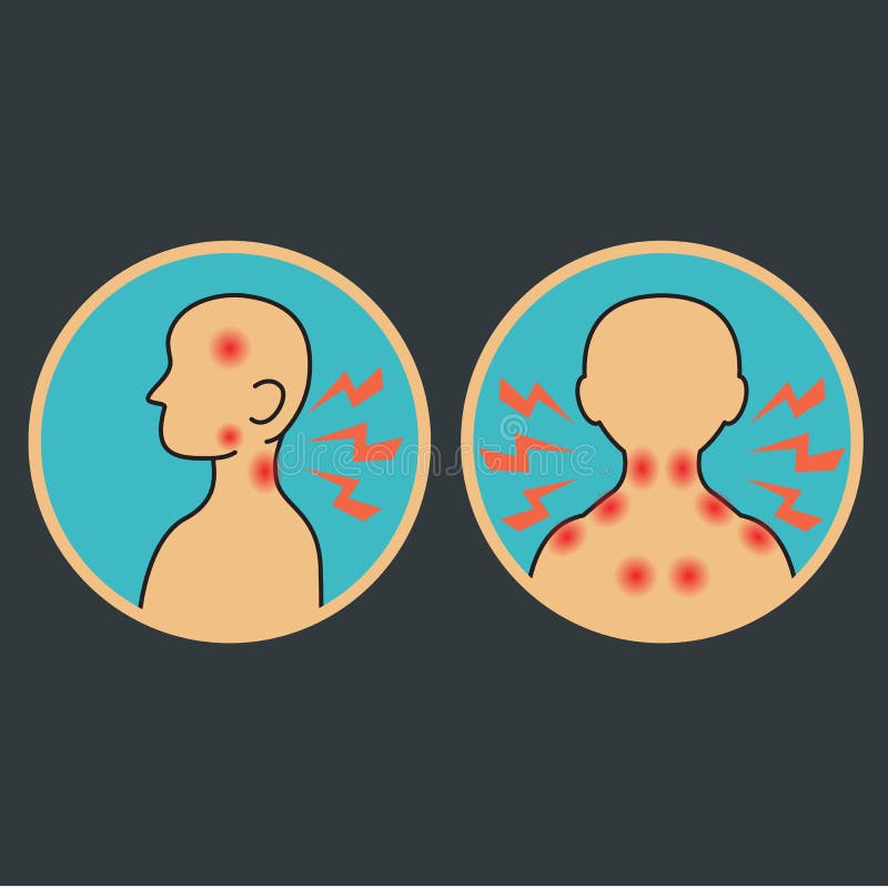 Headache Line Icon Set. Included the Icons As Tension Headaches ...