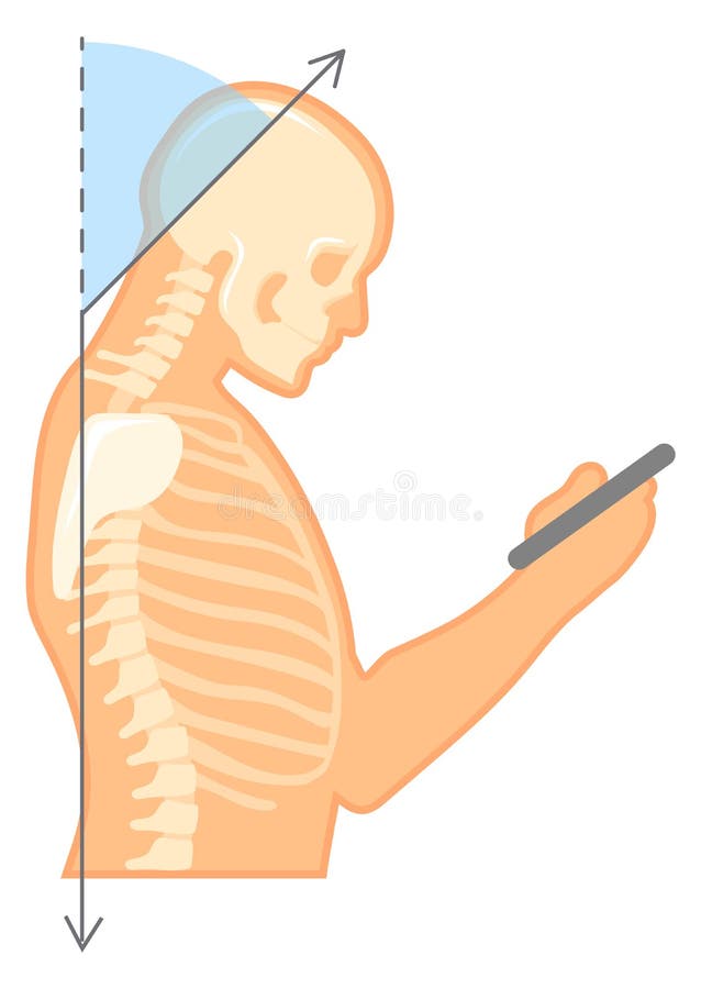 Correct Phone Posture Stock Illustrations – 66 Correct Phone Posture ...