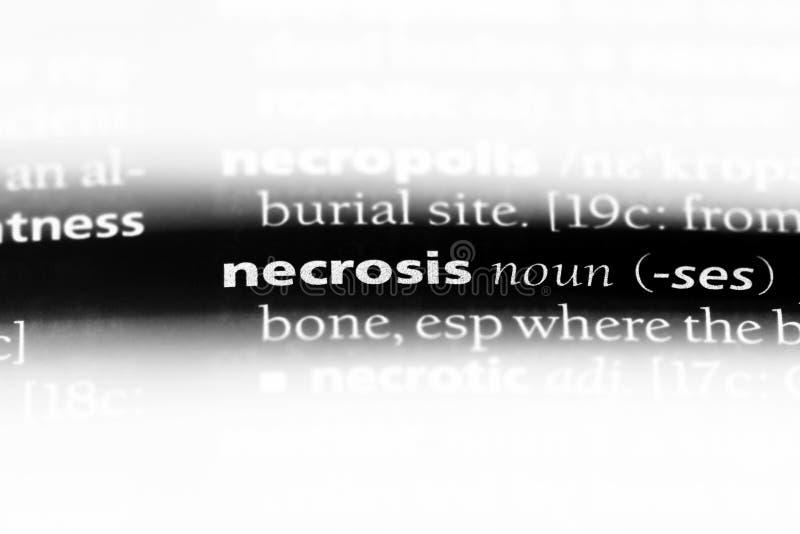 954 Necrose Fotos - Fotos de Stock Gratuitas e Fotos Royalty-Free ...