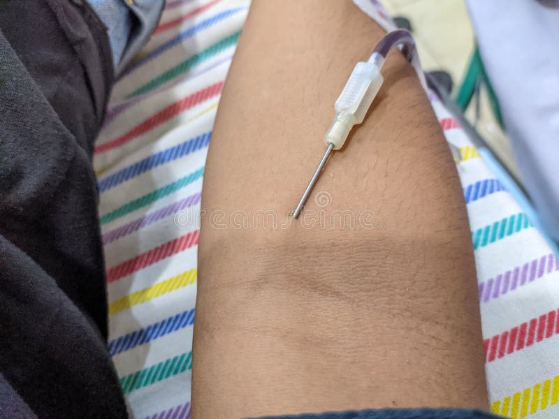 A Needle Pierced His Hand for Blood Transfusion Stock Photo - Image of ...