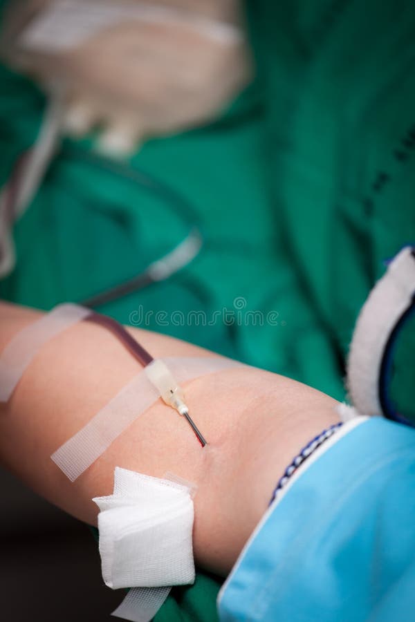 Arm of Blood Donator with Needle Stock Image - Image of knife, medical ...