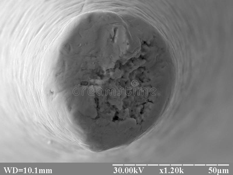 Needle Tip Surface Structure - 2 Stock Image - Image of micromorphology ...