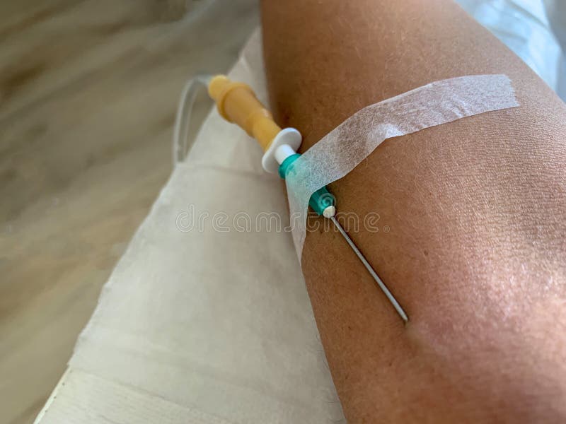 218 Fluids Injection Photos - Free & Royalty-Free Stock Photos from ...