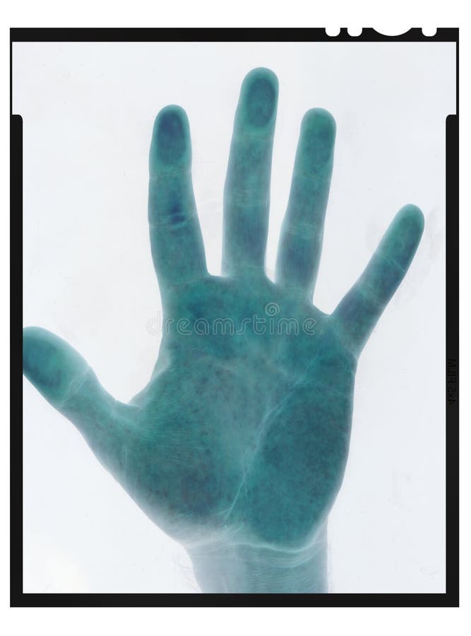Negative Hand Film stock illustration. Illustration of nature - 474719