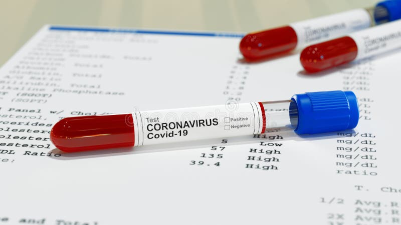 Negative or Positive Test Result by Using Rapid Test Device for COVID ...
