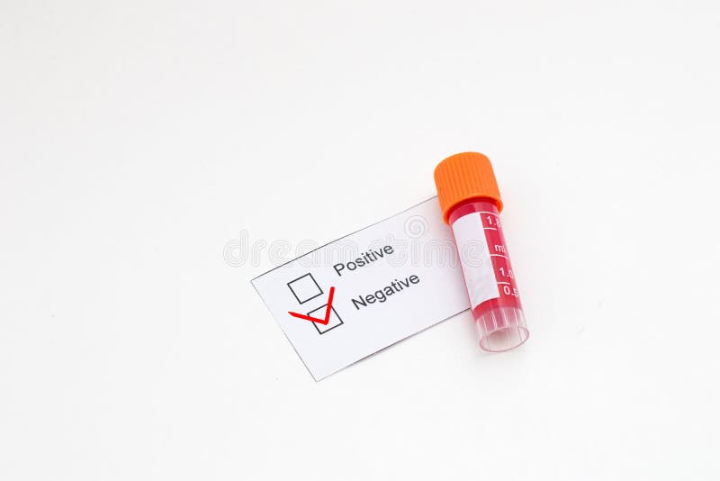 Negative Test and Laboratory Sample of Blood Testing Tube Stock Photo ...
