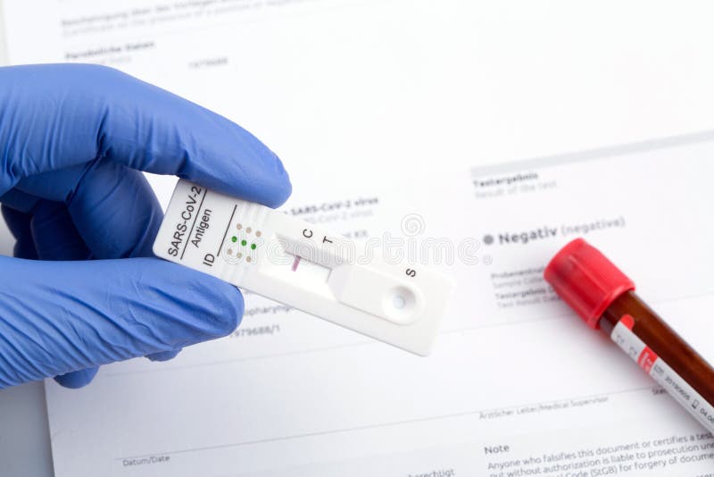 Negative Test Result by Using Rapid Test Device for COVID-19 Stock ...