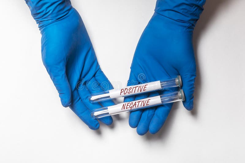 Negative Vs Positive Virus Test Results in Tubes. Blood Analysis Stock ...