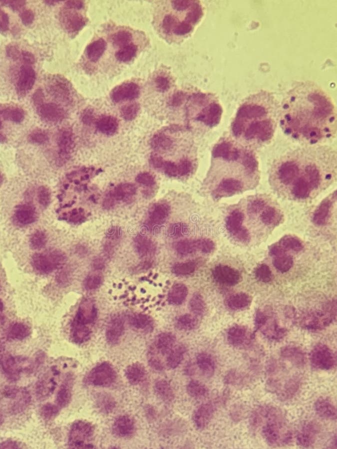 Neisseria Gonorrhea Intracellular Gram Negative Diplococci Stock Image Image Of Power