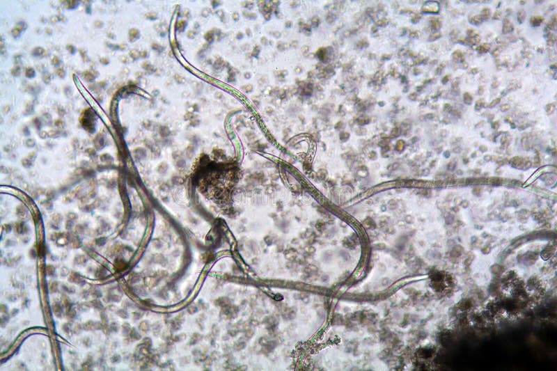 The Nematode Steinernema Feltiae Under the Microscope Stock Photo ...