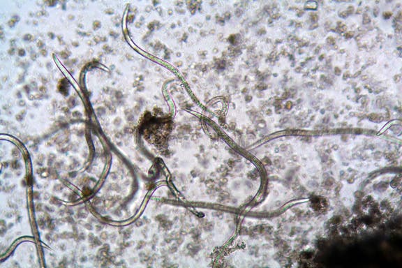 The Nematode Steinernema Feltiae Under the Microscope Stock Photo ...
