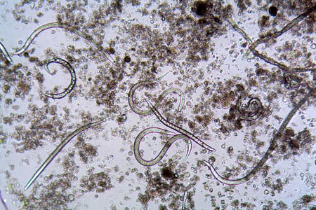 The Nematode Steinernema Feltiae Under the Microscope Stock Photo ...