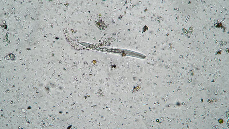 The Nematode Worm Moves among Numerous Clusters of Bacteria and ...