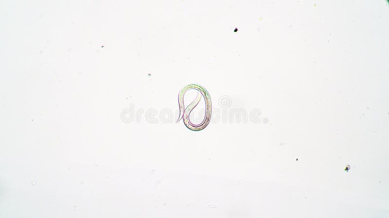 The Nematode Worm Moves in Undulating Movements Stock Footage - Video ...