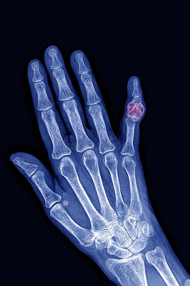 Middle Finger Skeleton Hand Stock Photos - Free & Royalty-Free Stock ...