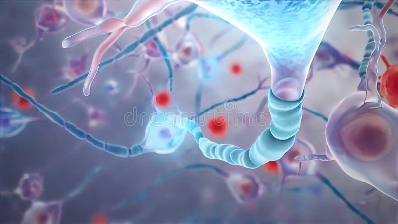 Nerve Cell Destructionin Multiple Sclerosis Stock Illustration ...