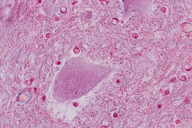 Nerve Human Under the Microscope. Stock Image - Image of lateral ...