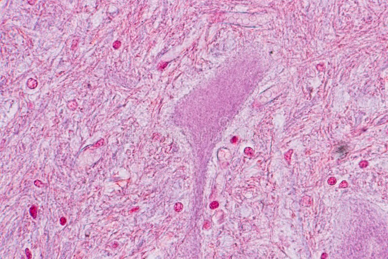 Nerve Human Under the Microscope. Stock Image - Image of cerebrum ...