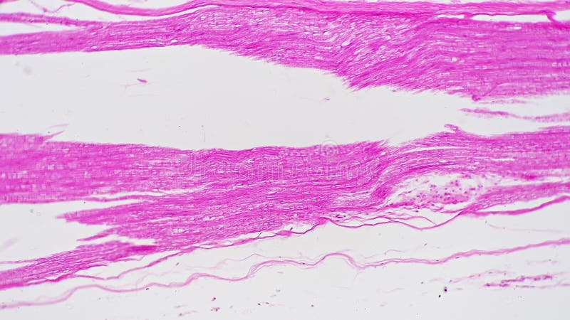 Nerves Trunk in Longitudinal Section Filmed Under Lab Microscope with ...