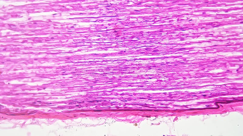 Nerves Trunk in Longitudinal Section Filmed Under Lab Microscope with ...