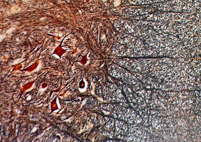 Nervous Tissue Under a Microscope Stock Image - Image of axon, grid ...