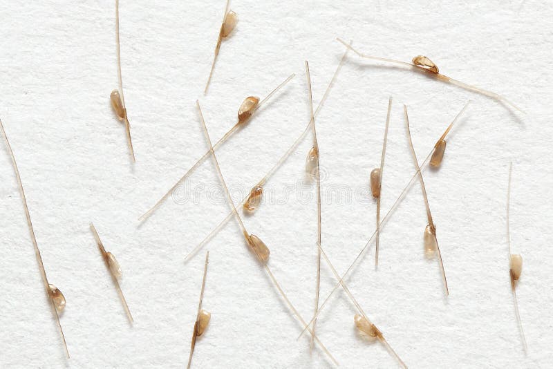 Neten Op Het Haar, Op Witboekachtergrond Stock Foto - Image of ...