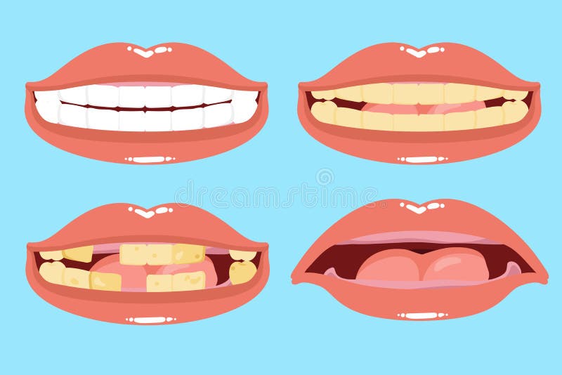 Süßer Cartoon-Mund vektor abbildung. Illustration von backenzahn - 90263280