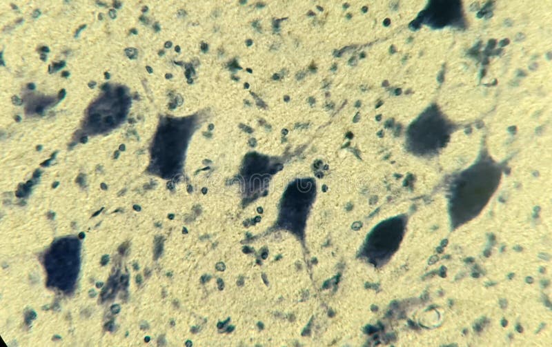 Neurocytes with Processes. Cell Structure of Nervous Tissue Stock Image ...