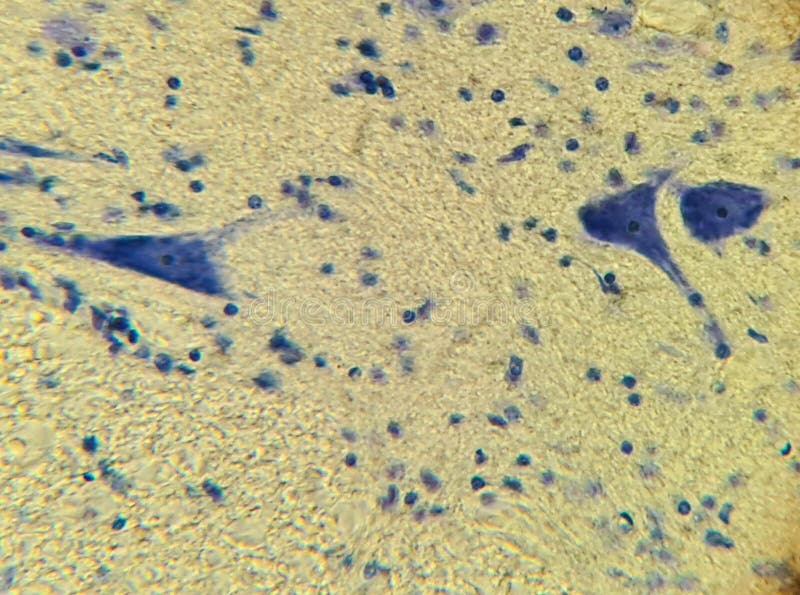 Neurocytes with Processes. Cell Structure of Nervous Tissue Stock Photo ...