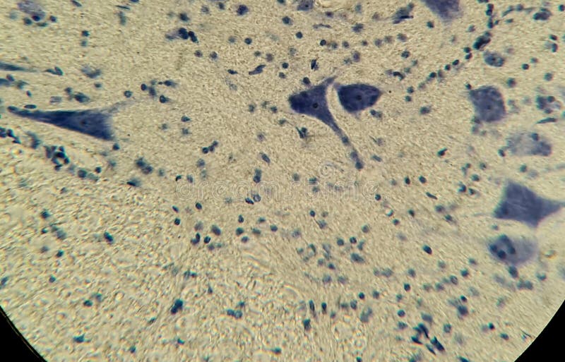 Neurocytes with Processes. Cell Structure of Nervous Tissue Stock Photo ...