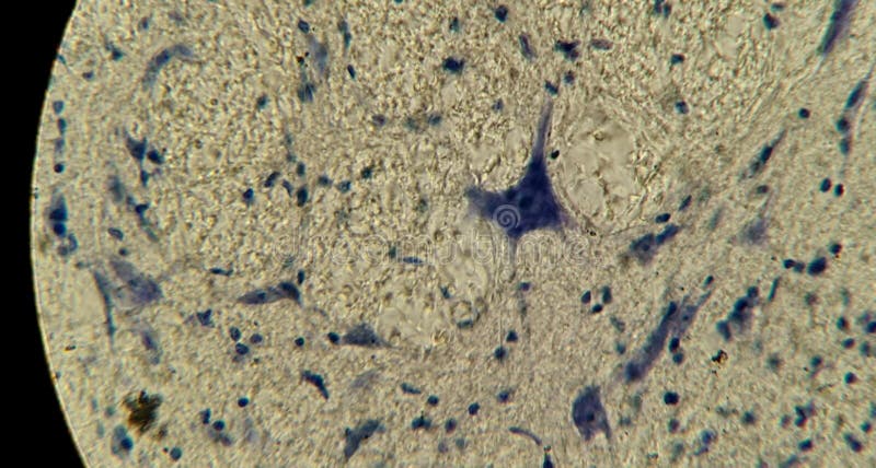 Neurocytes with Processes. Cell Structure of Nervous Tissue Stock Image ...