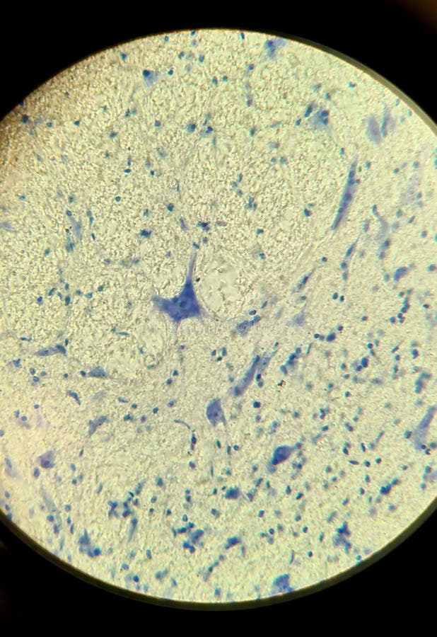 Neurite Stock Photos - Free & Royalty-Free Stock Photos from Dreamstime